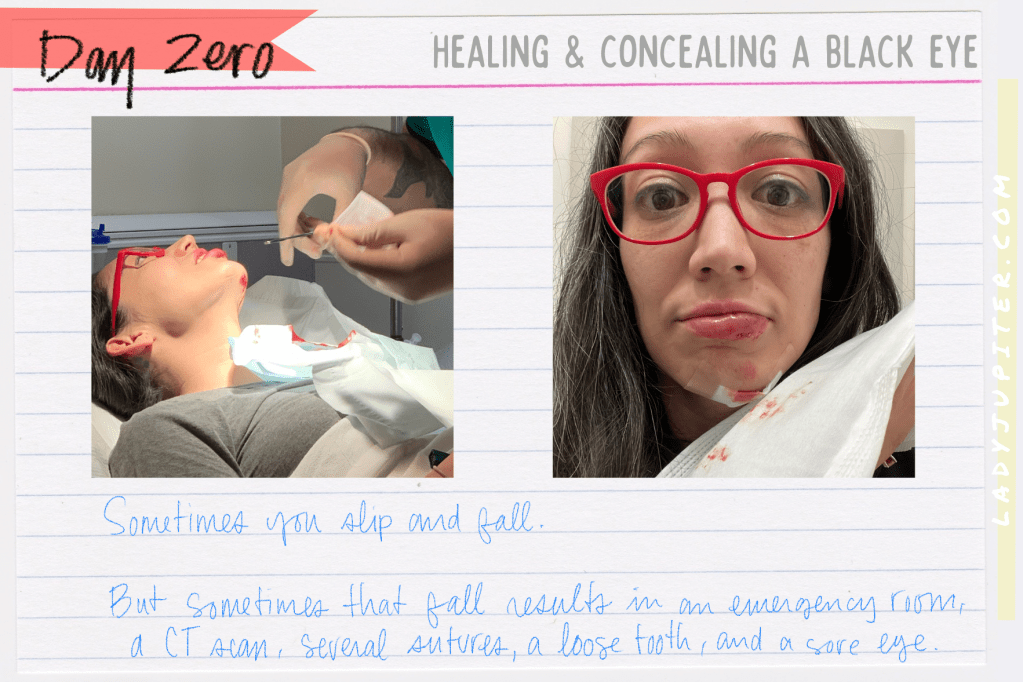 Healing & Concealing a Black Eye – Lady Jupiter