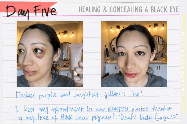 Healing & Concealing a Black Eye – Lady Jupiter
