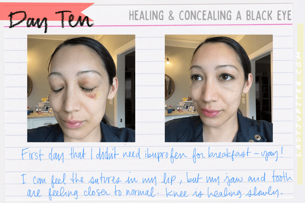 Healing & Concealing a Black Eye – Lady Jupiter