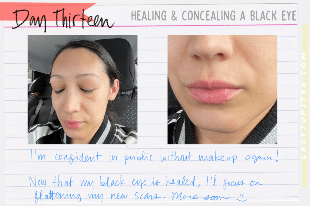 Healing & Concealing a Black Eye – Lady Jupiter