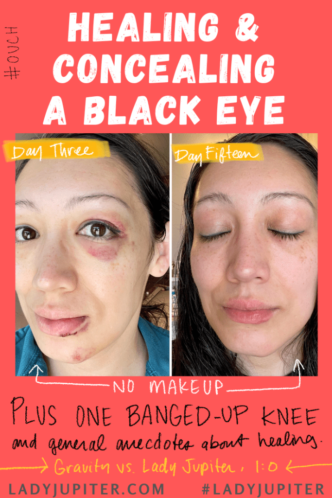 Healing & Concealing a Black Eye – Lady Jupiter
